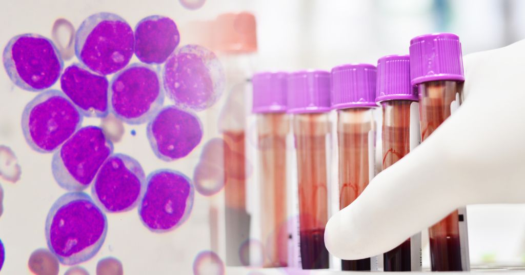 Asciminib di Novartis efficace nei pazienti adulti affetti da leucemia ...